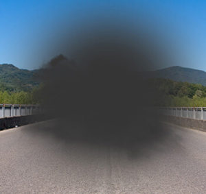 Macular Degeneration - Causes & Treatment | Boston Eye Group in Boston